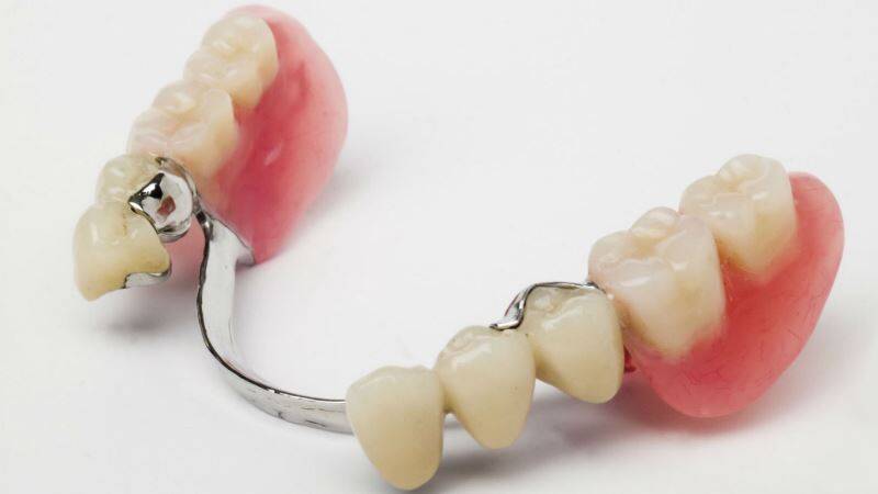 Vergoedingen – Visser Tandprothetiek – Anna Paulowna